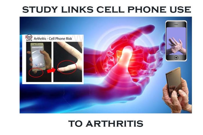 Arthritis Cell Phone Radiation Study * RF SAFE® Radio Frequency Safe