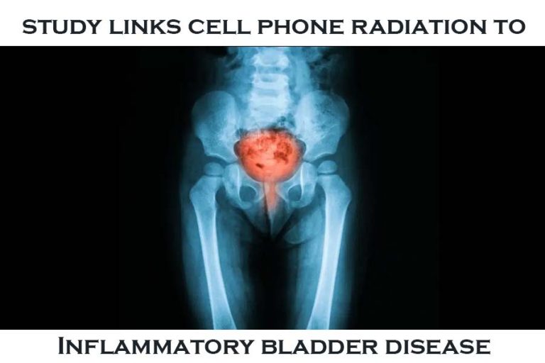 Inflammatory Bladder Disease Cell Phone Radiation Risk * RF SAFE® Radio ...