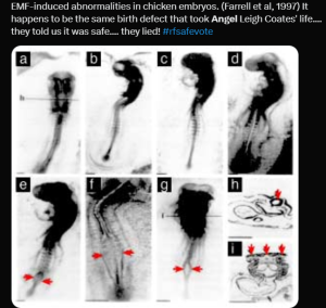 Neural Tubes, Autism, and Angel's Fate on the 28th Day of Life